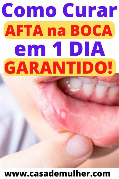 Como Curar AFTA Na BOCA Em 1 DIA Como Curar Afta Aftas Na Boca Afta