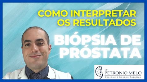 Como Interpretar os Resultados da Biópsia de Próstata Dr Petronio