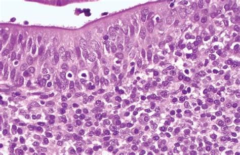Adenoids Description Histology Function Infection Britannica