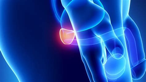Câncer de próstata tratamentos e cirurgia robótica Dr Eduardo Selbach
