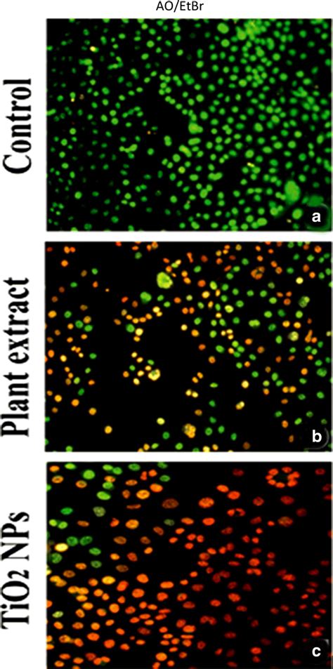 Determination Of The Morphological Changes In Human Cervical Carcinoma
