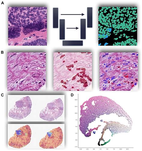 Artificial Intelligence Bioinformatics And Pathology Advances In