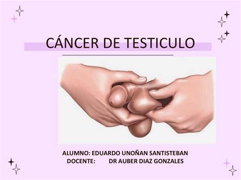 Cáncer de testículo Eduardo YS uDocz