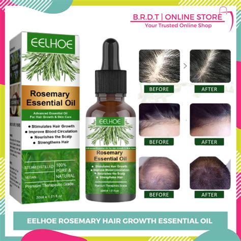 Eelhoe Rosemary Hair Growth Essential Oil Anti Hair Loss Fast Regrowth