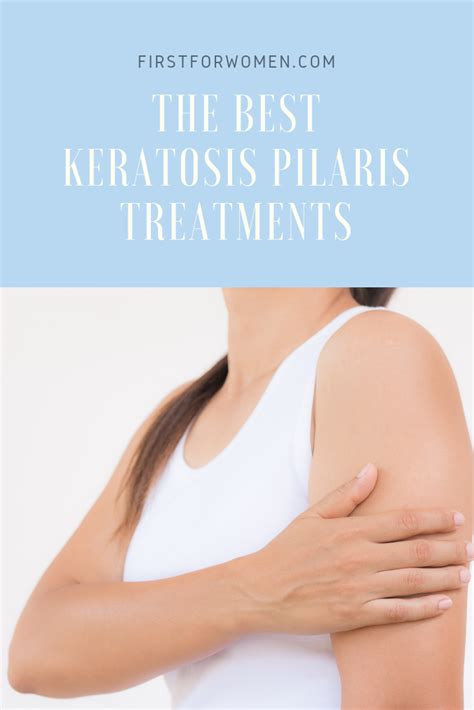 The Best Treatment For Keratosis Pilaris To Soothe Your Bumpy Skin
