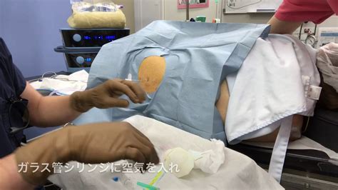 その①脂肪注入豊胸術硬膜外麻酔のようす YouTube