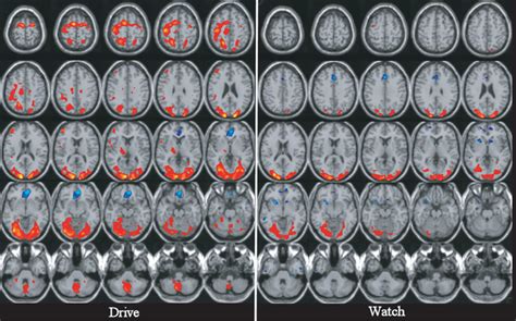 results from the glm based fmri analysis regression increases red download scientific