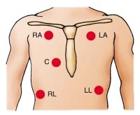 Craven Hirnle S Nursing Procedures And Fundamentals Online