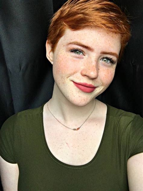 Tiernen E Rhm Submission Album On Imgur Beautiful Freckles