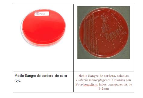 Hemólisis Alfa En Agar Sangre