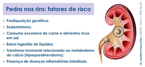 Cirurgia de pedra nos rins Como é feita e quando fazer Dr Jonathan
