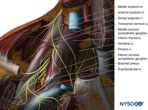 Anestesia Regional Anatomia Do Plexo Braquial No Espa O Interescal Nico