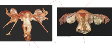 Female Pelvic Viscera Cadaver Diagram Quizlet