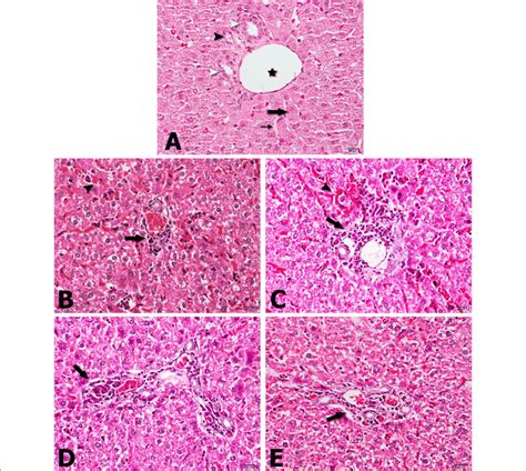 Photomicrographs Of Liver A Normal Microscopic View Of The Organ With
