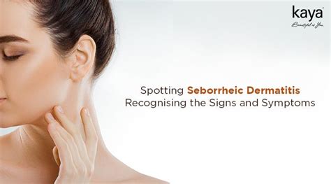 Common Symptoms Of Seborrheic Dermatitis Blog