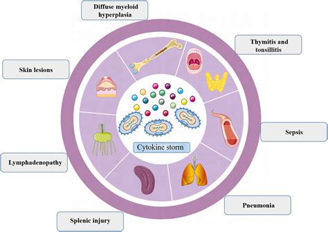 The Land Scape Of Immune Response To Monkeypox Virus EBioMedicine