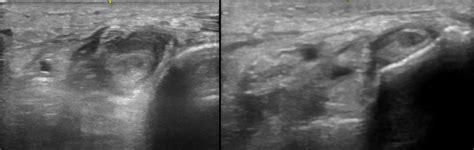 Audit Essay MSK Ultrasound Sports Medicine Ultrasound Group