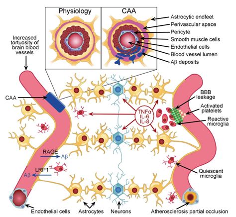 Illustration Of Some Pathophysiological Changes That Could Affect