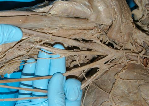 Upper Extremities