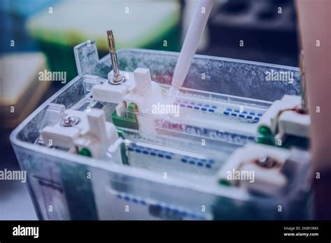 Western Blot Analysis Use As Protein Analysis For Protein Detection