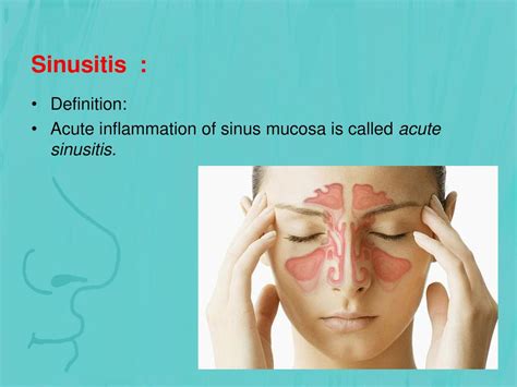 Sinusitis Types Causes Symptoms Complications And 50 OFF