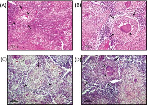Hematoxylin Eosin Staining For Identification Of Granulomatous