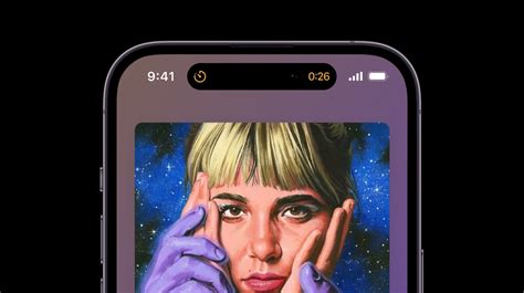 Dynamic Island Animation IPhone 14 Pro Figma