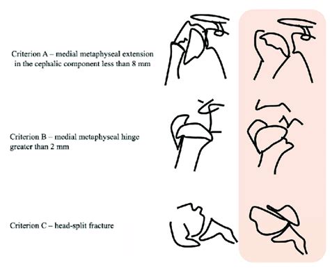 The Three Hertel Criteria Adopted In The Study Criterion A Represents