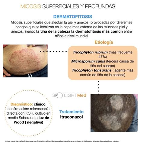 Micosis Superficiales Y Profundas 1 En 2021 Superficial Profundo
