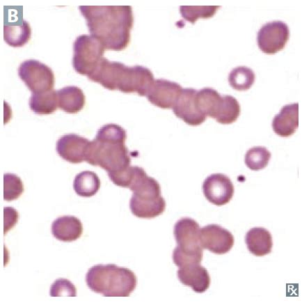 Clin Lab Red Blood Cells Wbc Anemia Platelets Flashcards Quizlet