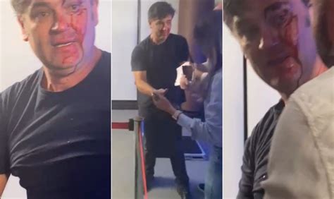 Saiba quem é Duda Lima marqueteiro de Nunes agredido por assessor de
