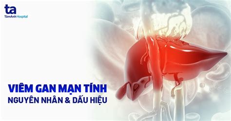 Tìm hiểu về bệnh gan mãn tính là gì và cách phòng tránh bệnh
