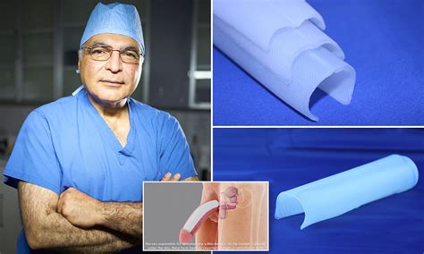 Penis Implant Porn Telegraph
