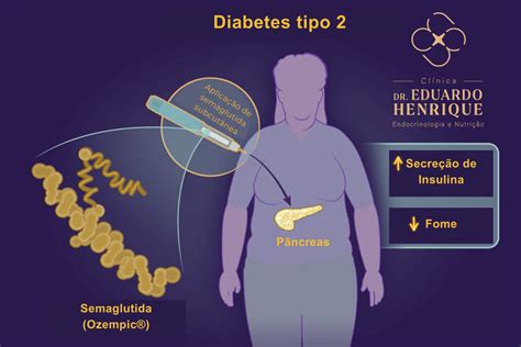 Ozempic Semaglutida conheça mais sobre a medicação