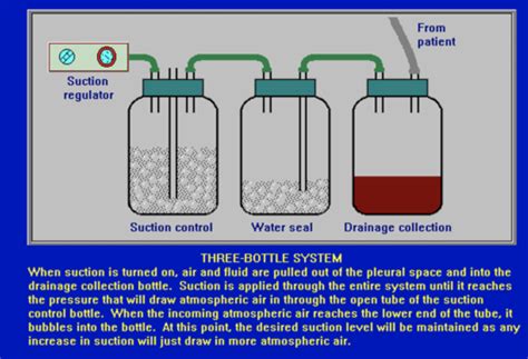 Medical Procedures Flashcards Quizlet
