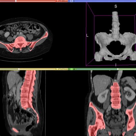 pdf ct org a new dataset for multiple organ segmentation in computed tomography