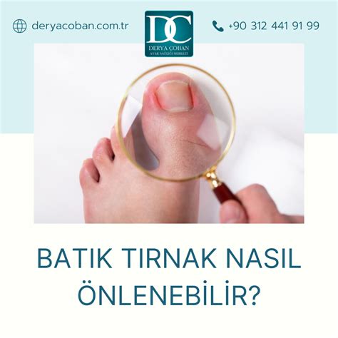 Batık Tırnak Uygulamaları Tırnak Batması Nedir Nasıl Tedavi Edilir