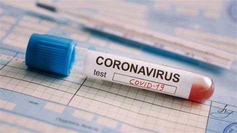 Nueva Prueba De COVID 19 Entrega Resultados En Solo 45 Minutos