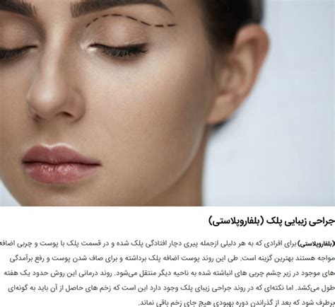 Discover The Most Common Plastic Surgery Procedures A Comprehensive Guide