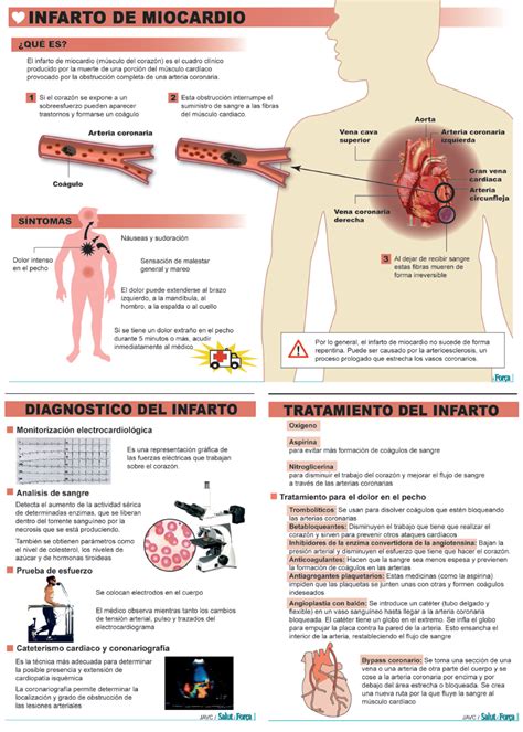 Infarto Agudo Al Miocardio Beneficios De La Resonancia Magnetica Para