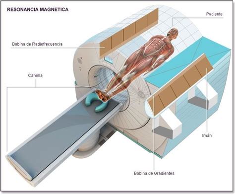 Cómo funciona la Resonancia Magnética Kenza