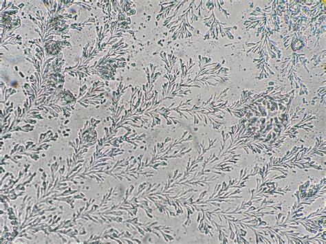 Cervical Mucus Under Microscope