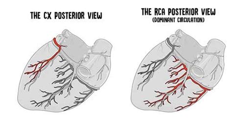 Stemi Nstemi A Nurse S Comprehensive Guide Artofit