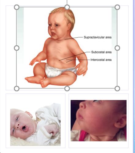 Emergency Care Of The Pediatric Population Flashcards Quizlet