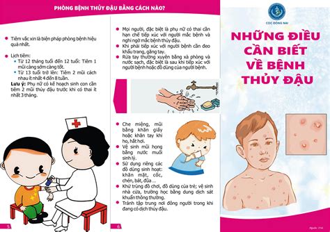 Những điều cần biết về bệnh thuỷ đậu