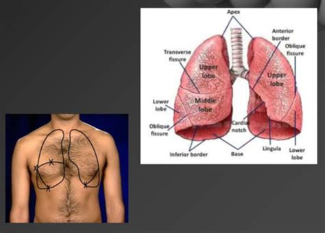 Pleura Lungs Flashcards Quizlet