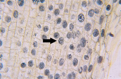 Onion Root Cytoplasm