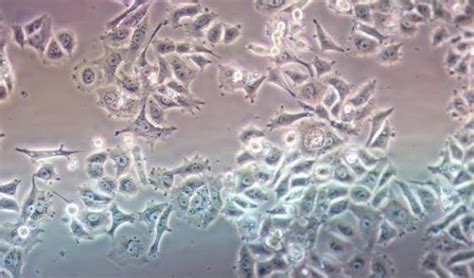 Mycoplasma Contamination In Cell Culture