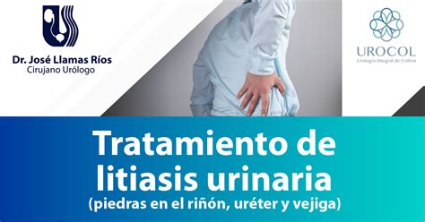 Tratamiento De Litiasis Urinaria Piedras En El Ri N Ur Ter Y Vejiga