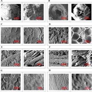 SEM Images Of The Outer And Inner Surfaces Of The Fruit And Seeds